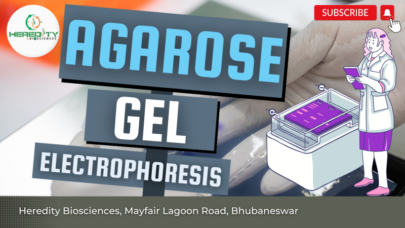Agarose Gel Electrophoresis: Step-by-Step Procedure, Principle, and ...